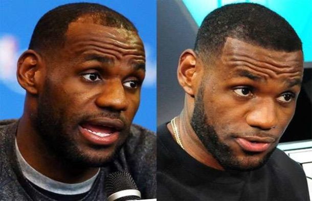 Lebron-James-Hair-Transplant | Hold the Hairline